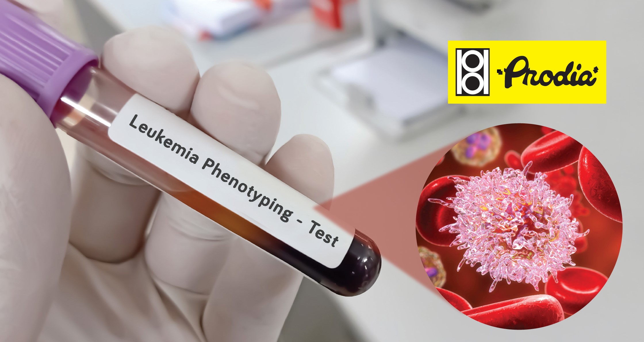 Bantu Deteksi Tipe Kanker Darah bagi Pasien Leukemia Akut, Prodia ...